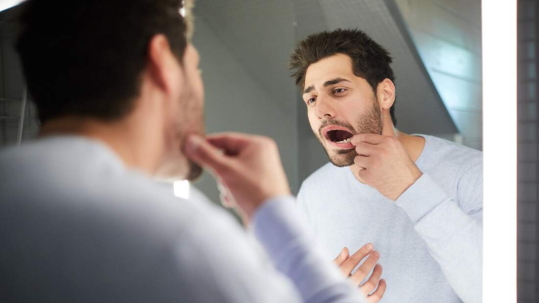 Aphthen im Mund: 5 hilfreiche Tipps | MEN'S HEALTH