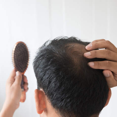 Haarausfall stoppen: So beugst du einer Glatze vor - MEN'S HEALTH