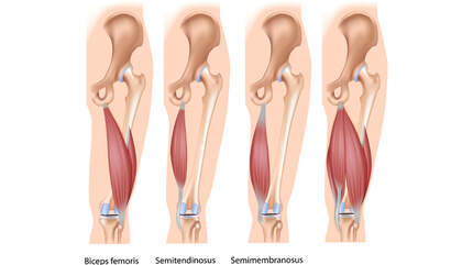 Hamstrings trainieren: die 3 effektivsten Übungen