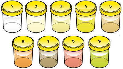 Urinfarbe: Das steckt dahinter | MEN'S HEALTH